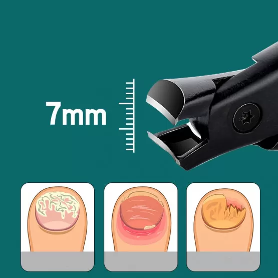 INF Kraftig nagelklippare för tjocka tånaglar